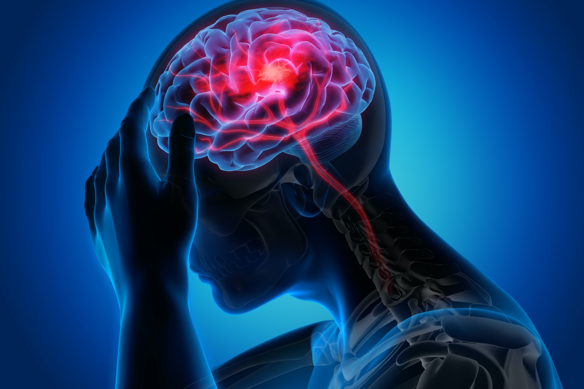 Migraines - Eleanor Strang Nutrition