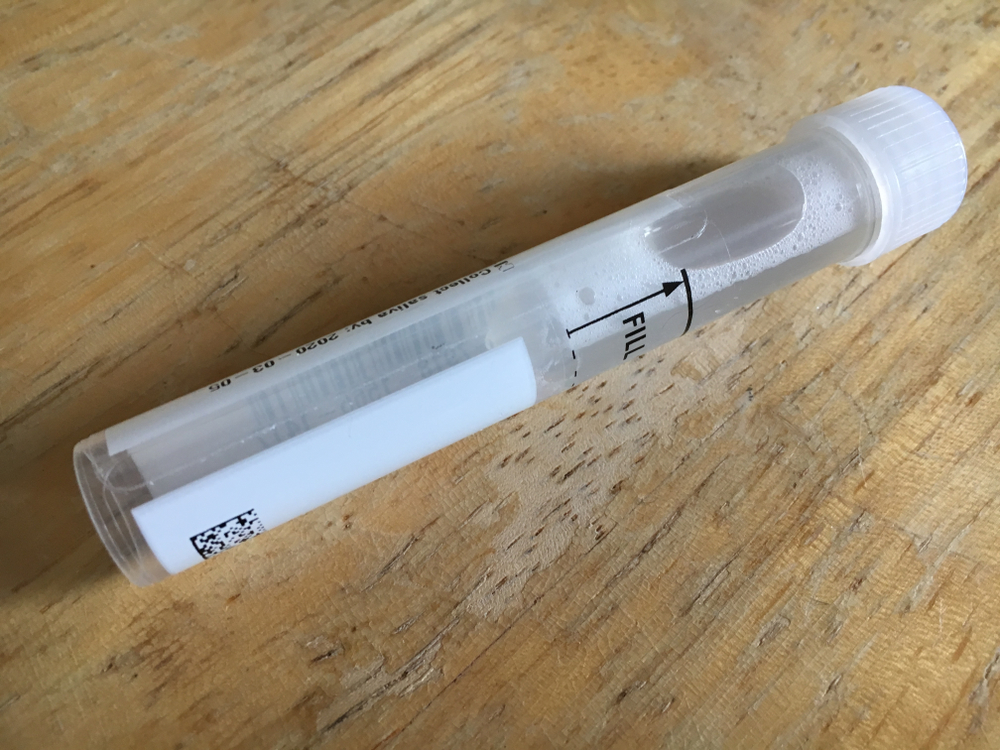 Saliva testing for Immune Reactivity: Cyrex Array 14 - Eleanor Strang ...